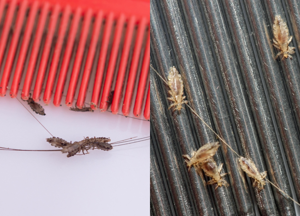 Head Lice: 10 Myths & Facts – Safe Solutions